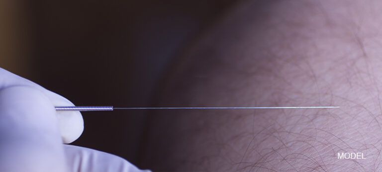 Hook Skin: Perfect Your Technique with Specialized Surgical Hooks | Robbins Instruments